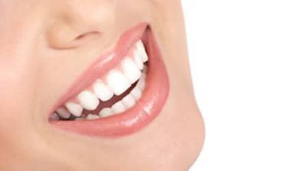 Gummy Smile Botoks | 2025 Fiyatları - Op. Dr. Leyla Arvas